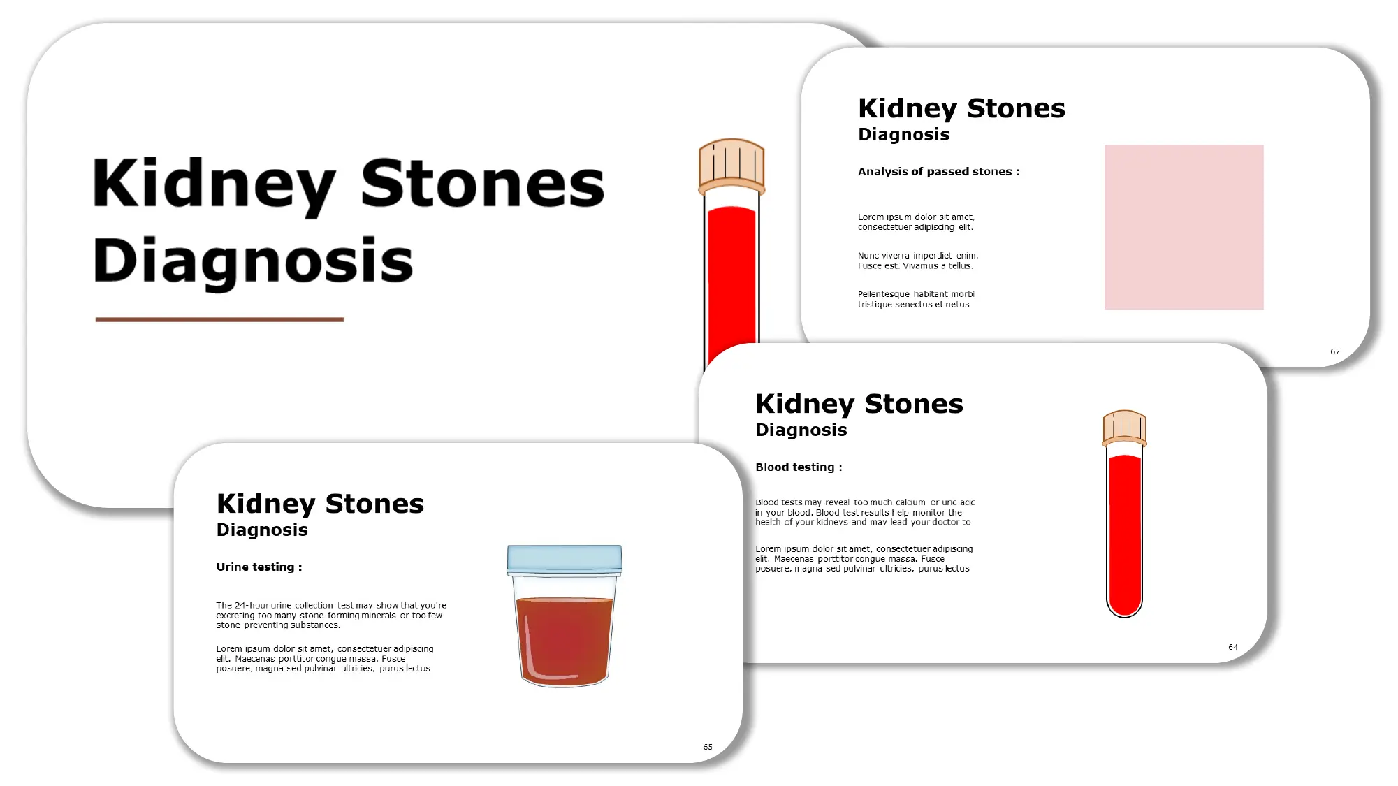 Download kidney Stones PowerPoint Template|RxSlides